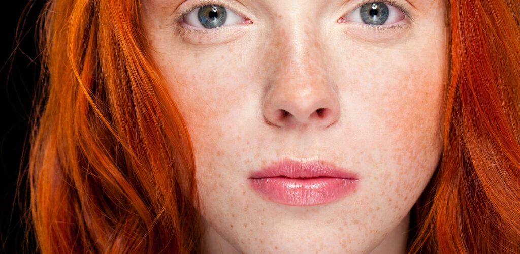 Irish People Red Hair